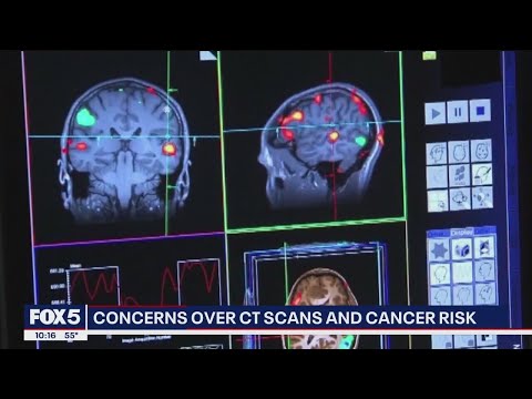 Concerns over CT scans and cancer risk