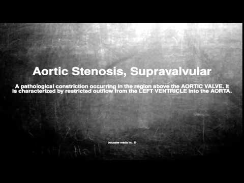 Medical vocabulary: What does Aortic Stenosis, Supravalvular mean