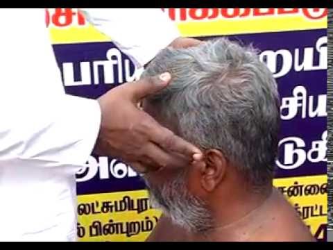 VARMA THERAPY-வர்ம மருத்துவம-part-2 தலைவலி குணமாகும் வர்மங்கள்