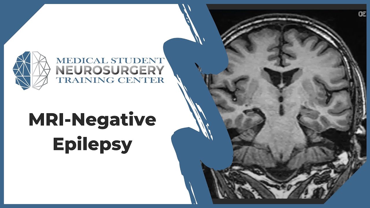 MRI-Negative Epilepsy