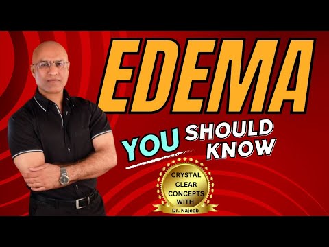 Edema | Types Causes and Symptoms👨‍⚕️