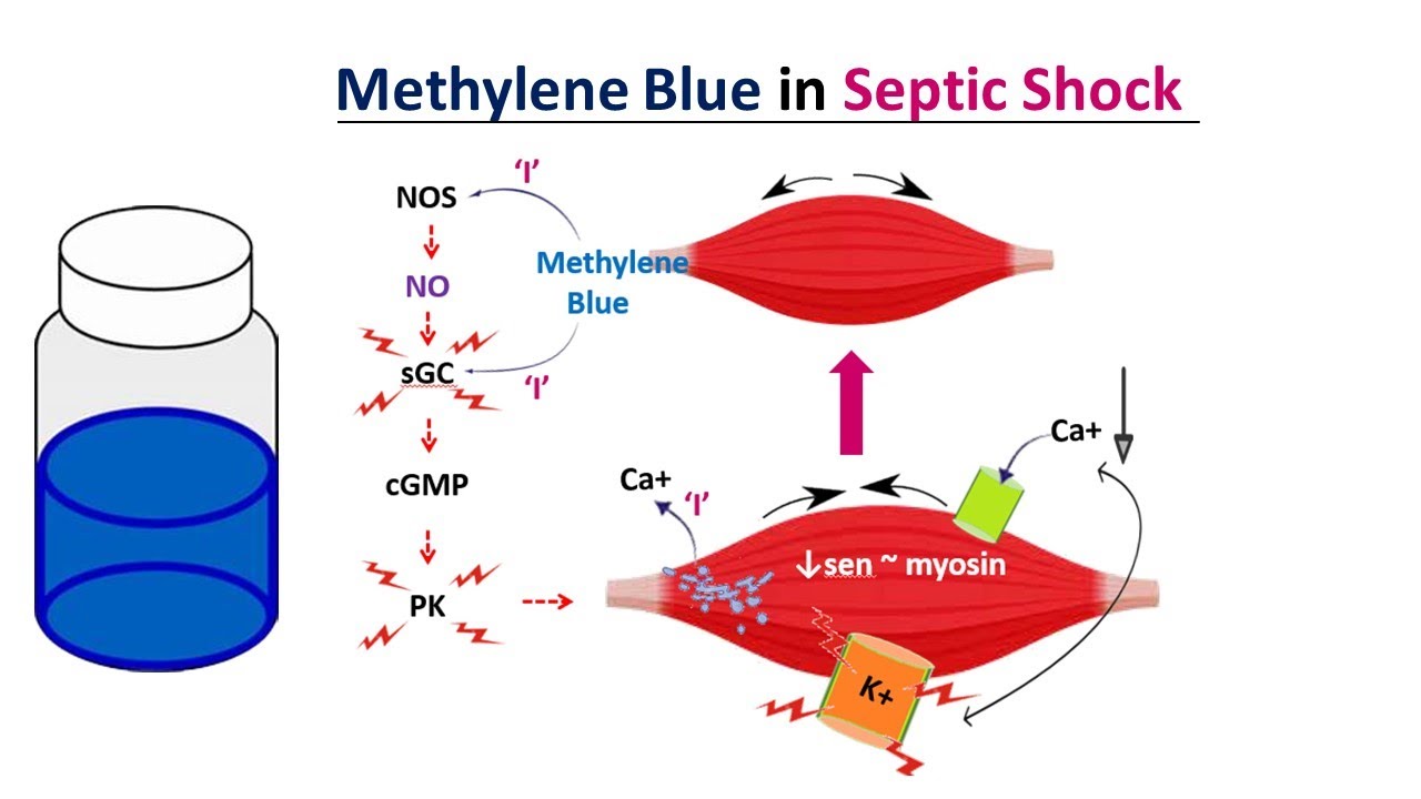 Exploring Methylene Blue in Septic Shock: Insights from Recent Trials ...