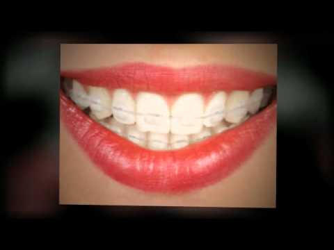 Premier Orthodontic Care in Chantilly, VA – Dr. Anisa Omar, DDS | Anisa ...