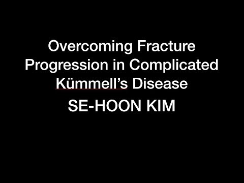 Se- Hoon Kim Overcoming Fracture Progression in Complicated Kümmell’s Disease
