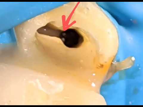 Retrieval By Dr. Mina