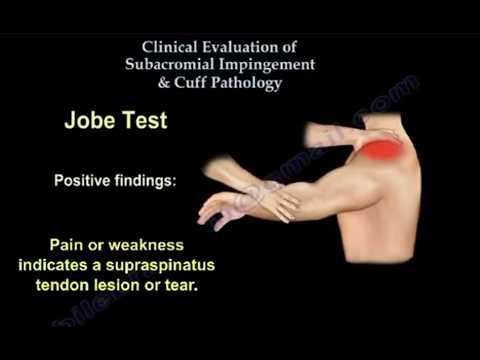 Clinical Shoulder Examination and Rotator Cuff Tests Explained • Video ...