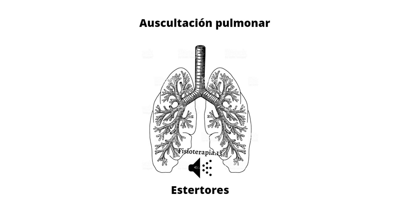 Ruidos respiratorios agregados - Estertores