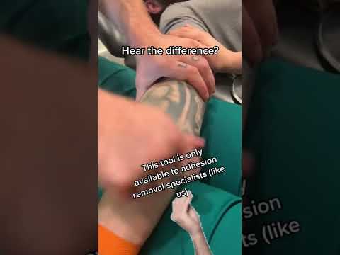 Self Myofascial Release Instrument - One Works and One Doesn’t (NOTICE THE CRUNCH)