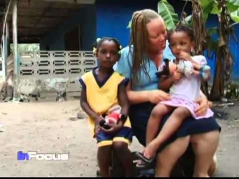 Albinism in Africa