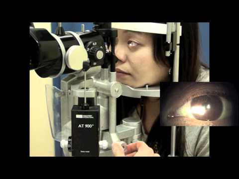 visual aid: slit lamp tutorial | DAILYEM