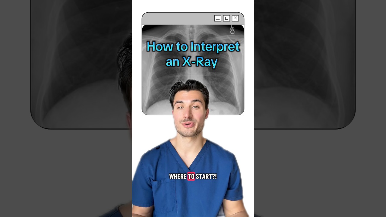 How to Interpret a Chest X-Ray 🩻#medstudent #medschool #usmle #usmlestep1 #usmlestep2 #xray
