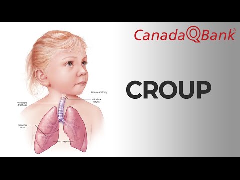 Croup (Laryngotracheobronchitis)