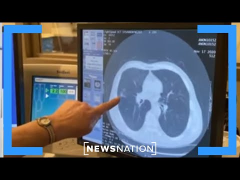 New study finds 12 symptoms of long coronavirus | NewsNation Live