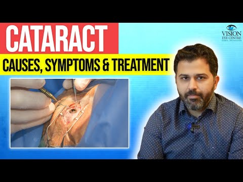 What is Cataract: Causes , Symptoms & Treatment | Best Treatment For Cataract | Best Lens
