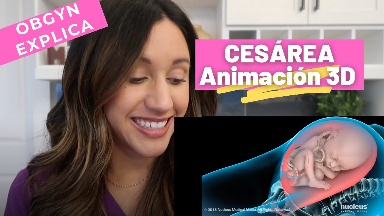 CESÁREA: Animación 3D | Doctora Explica!