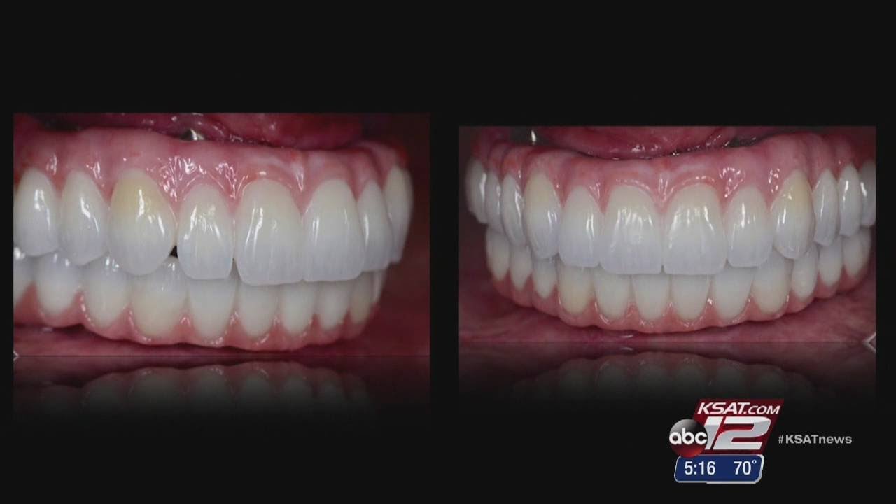 VIDEO: CAD CAM: Making New Teeth