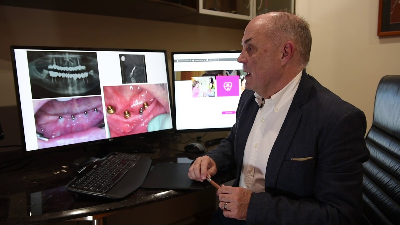 The Problem With Mini Implants