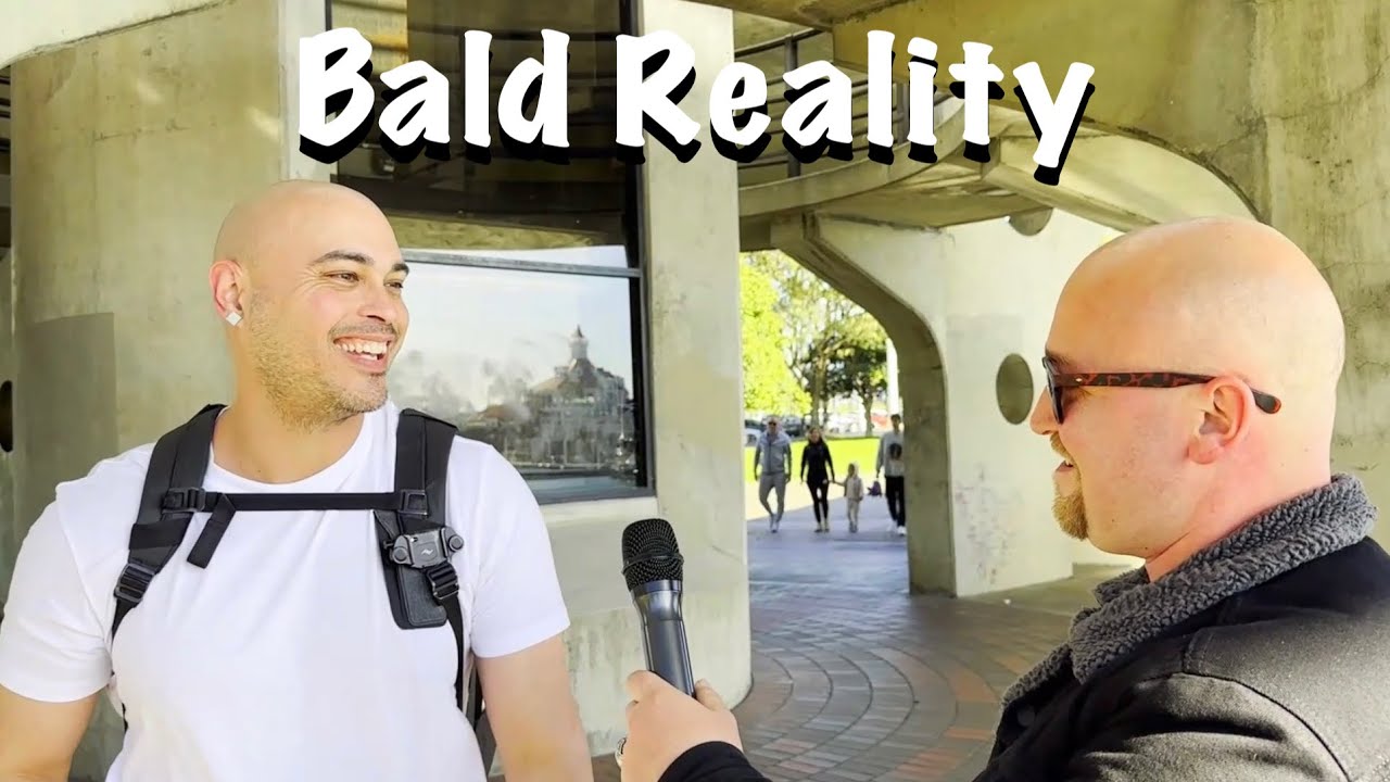The Truth About Being Bald | Ep. 1