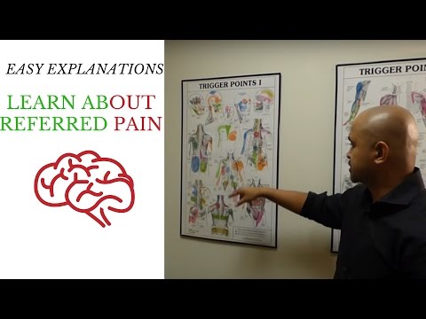 8 Questions: About Referred Pain