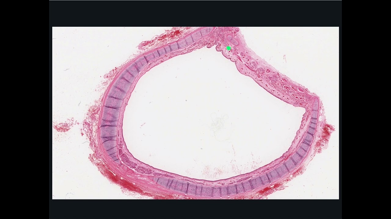 Respiratory System Histology - Trachea