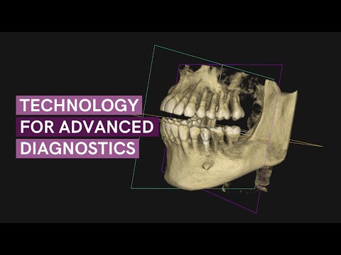 Technology for advanced diagnostics