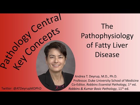 Medical School Pathology: The Pathophysiology of Fatty Liver Disease