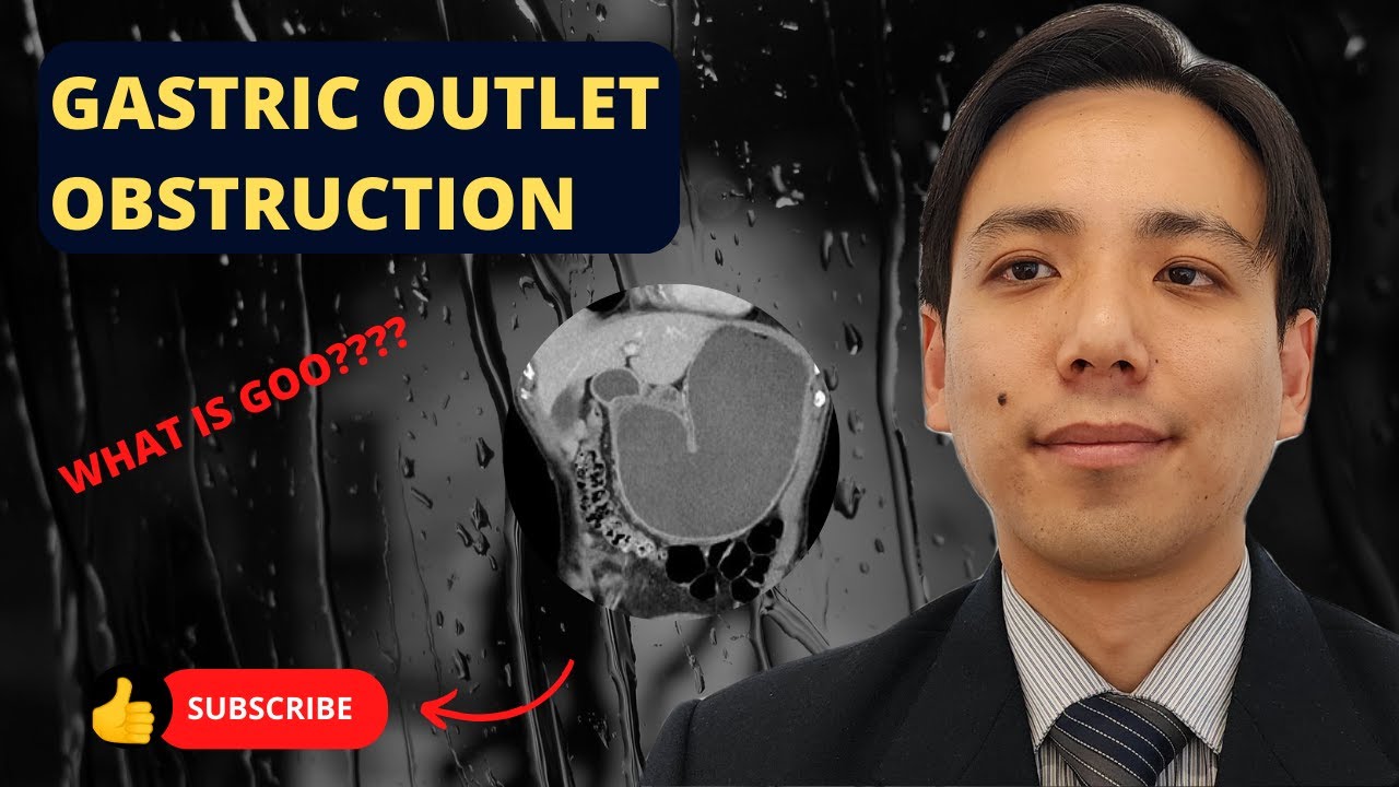 How do you manage gastric outlet obstruction?