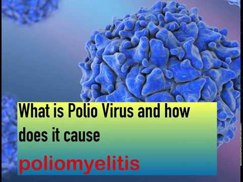 Polio Virus Simple Explanation with How it causes poliomyelitis