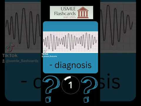Torsade de pointes #usmle #cardiology #cardiología cardiologia #flashcards