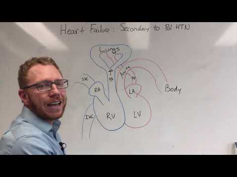 Exam Question | Heart failure Secondary to COPD