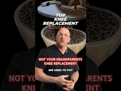 2024 Knee Replacement Tech - Is It Getting Any Better? #shorts
