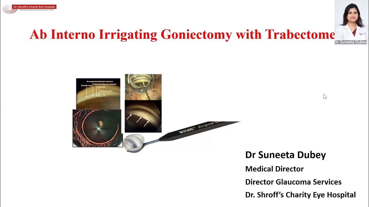 Trabectome - Dr. Suneeta Dubey