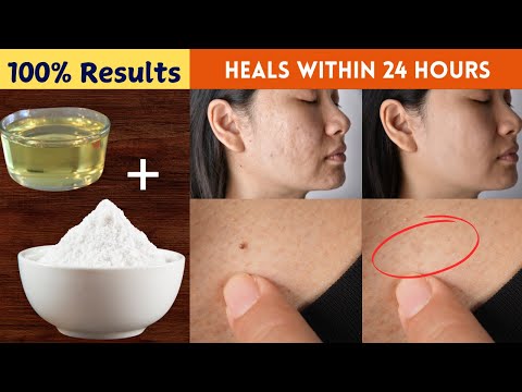 Mix Castor Oil & Baking Soda to HEAL 6 Things in 24 hours
