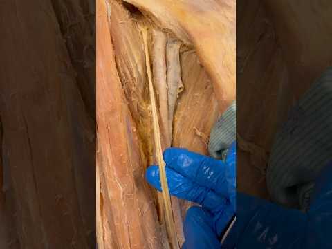 Real Femoral Artery & Nerve!