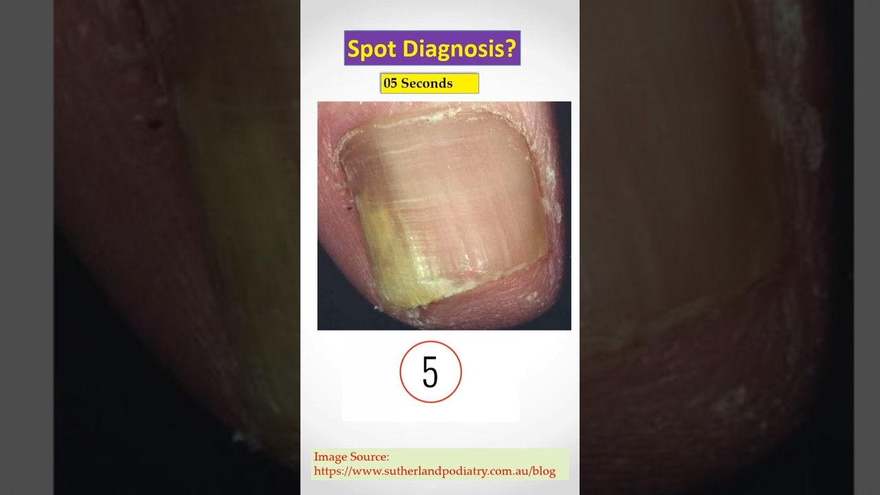 Dermatology Spot Diagnosis Quiz #34. Doctors, check your Clinical Skill