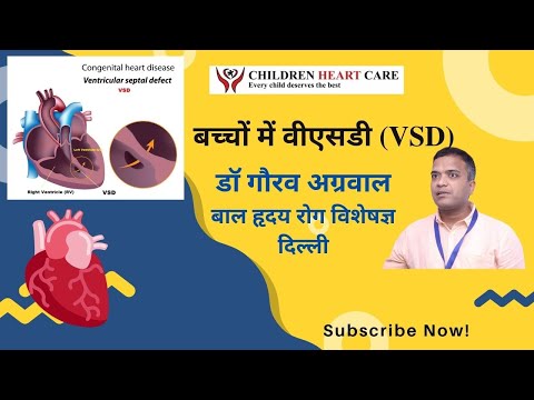 वेंट्रिकुलर सेप्टल डिफेक्ट (VSD) (हिंदी) in children: डॉ गौरव अग्रवाल, बाल दिल रोग विशेषज्ञ, दिल्ली