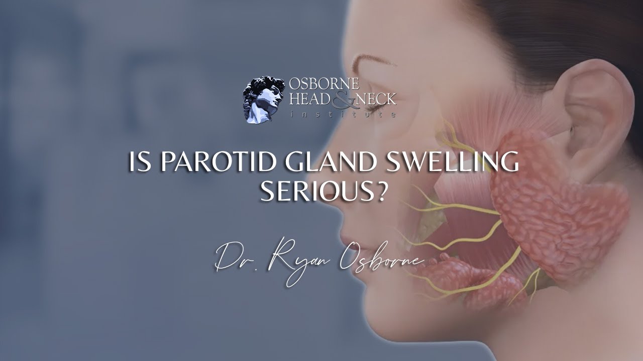 Is parotid gland swelling serious?