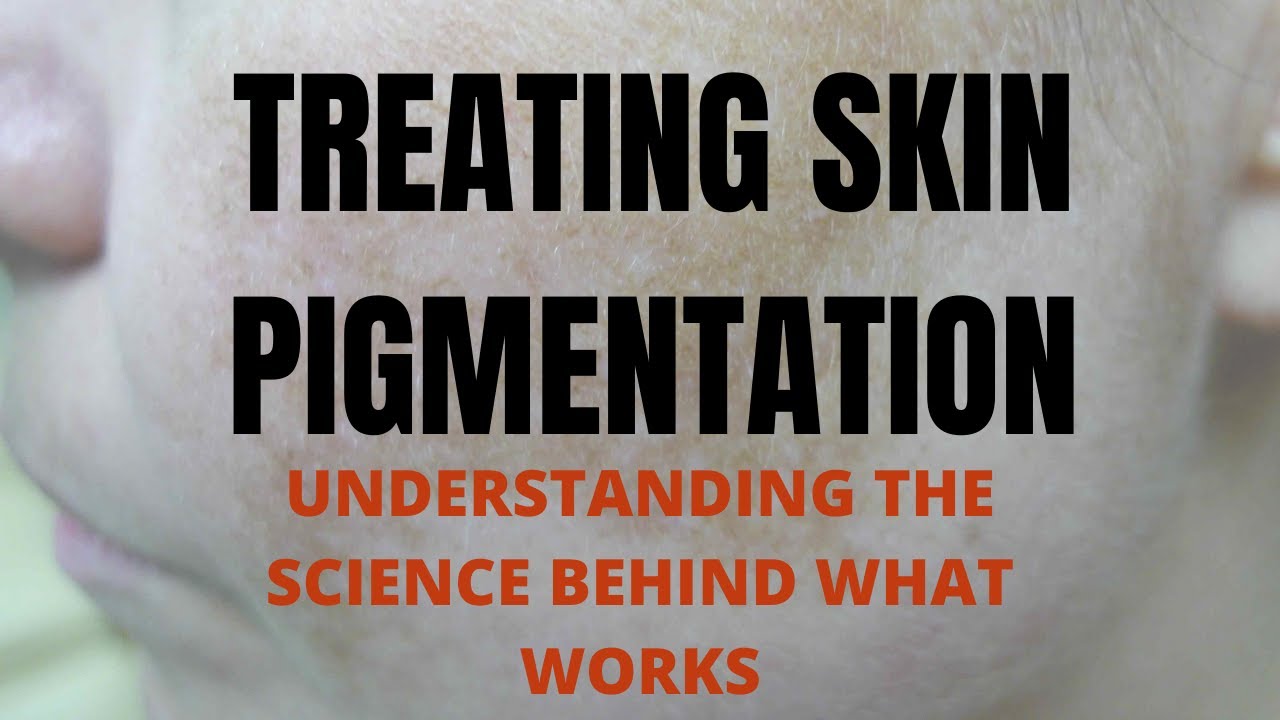 How to treat facial pigmentation without marketing | Dermatologist & Compounding Pharmacist Insights