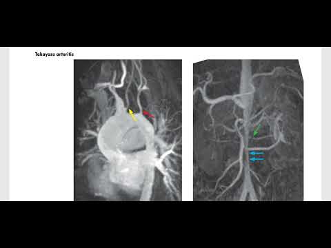 Vascular imaging core radiology visualsㅣradiopaedia@ctisus @navigatingradiology