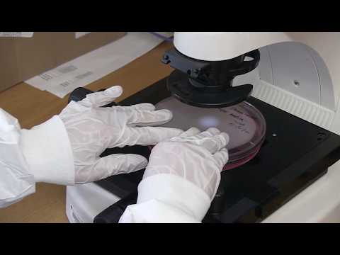 Princeton Innovation: Inhibitors of hepatitis B and E virus infection
