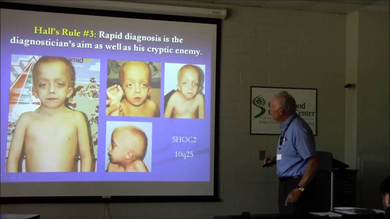 Hall's Rules of Dysmorphology - Part 1 - Dr. Bryan Hall