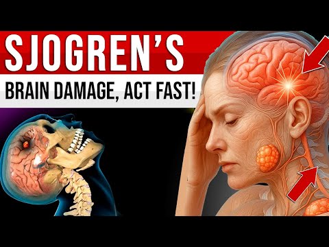 Sjogren's Syndrome Disease BRAIN and NERVOUS System Damage! (This Could Save Your Life!)