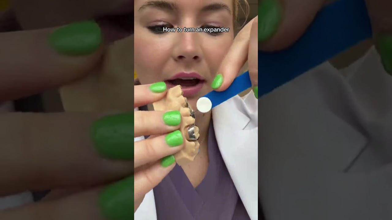 How to turn your expander 101!!! #expander #braces