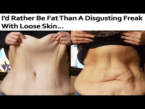 r/FatLogic | My Fat Looks Better Than Their Loose Skin