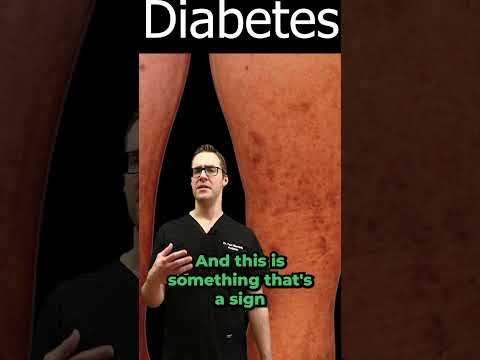 Diabetic Dermopathy Pictures & Treatment [Diabetes Symptoms & Signs]