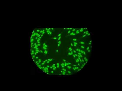 immunofluorescence test shows antibodies against Topoisomerase I.