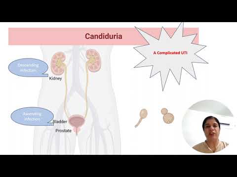 Candiduria | Candida in urine | Candiduria treatment | Candida UTI diagnosis | Yeasts in urine