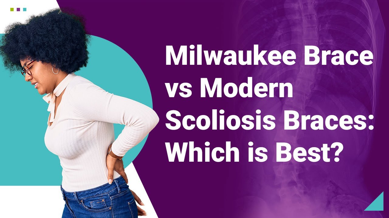 Milwaukee Brace vs Modern Scoliosis Braces: Which is Best?