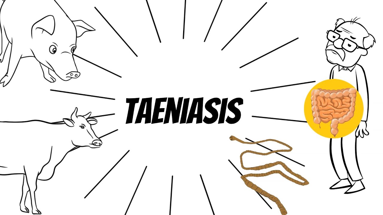 Taeniasis