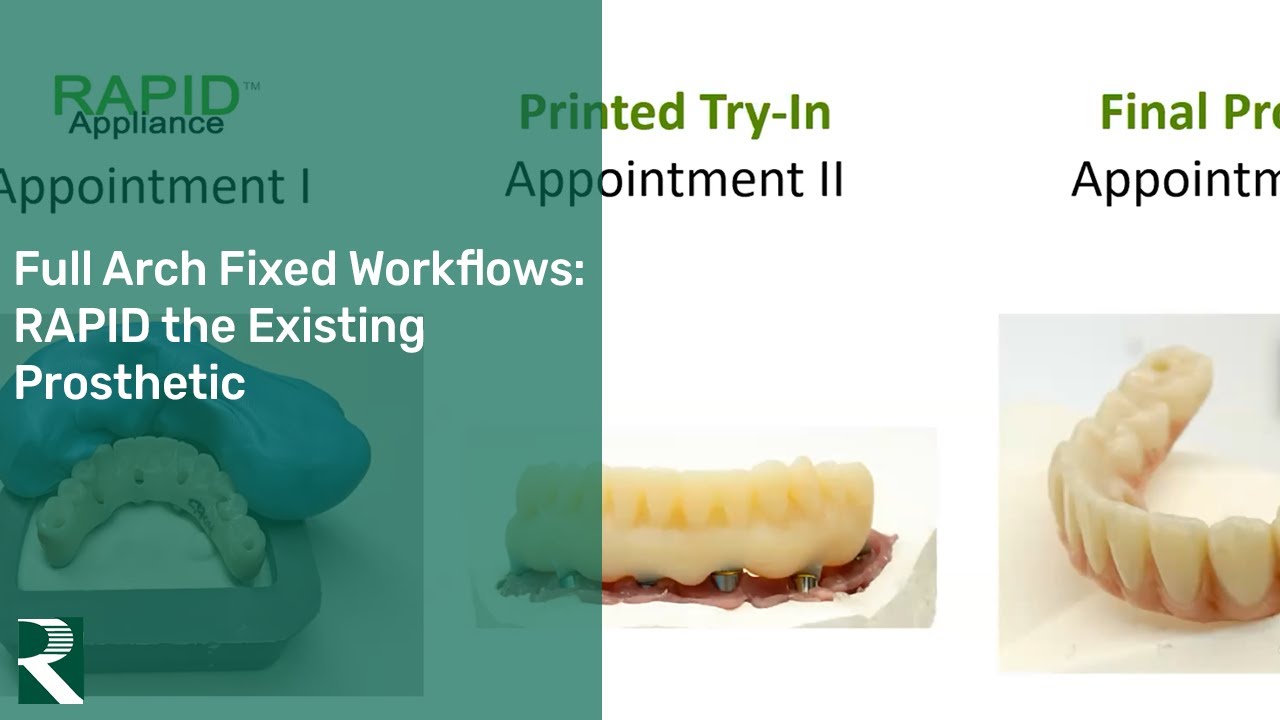 Fixed Full Arch Workflows  - RAPID the Existing Prosthetic
